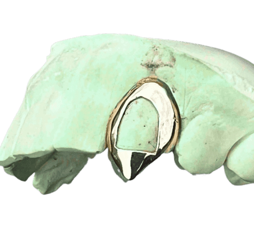 [Custom] 10K Gold Open Face Fang Grillz Single – Rhino Grillz