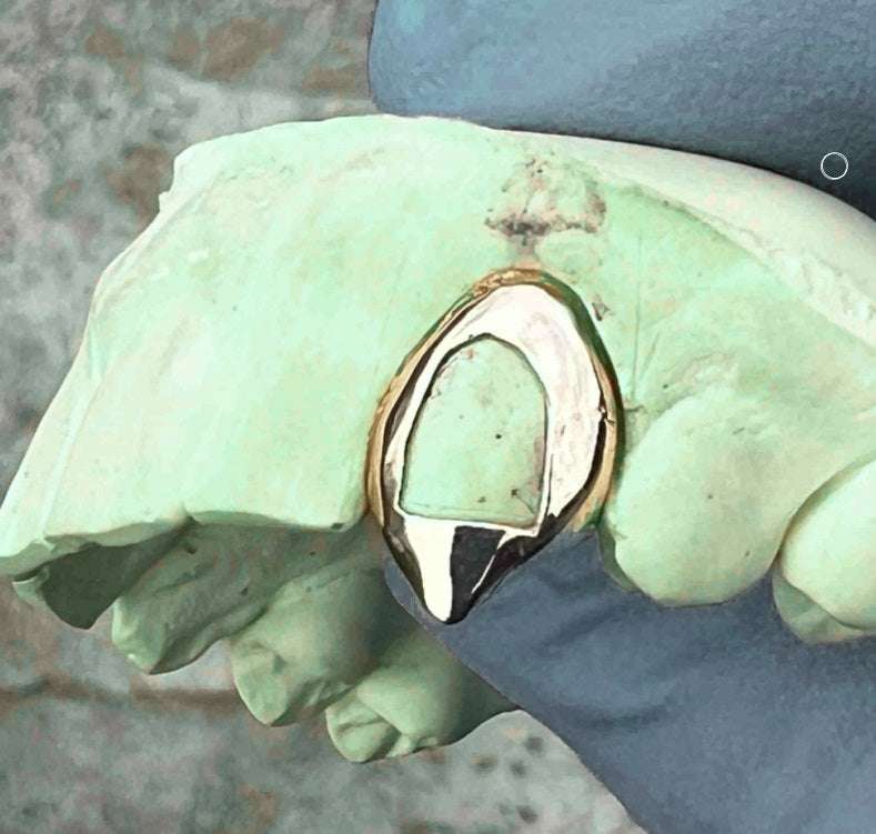 [Custom] 10K Gold Open Face Fang Grillz Single – Rhino Grillz