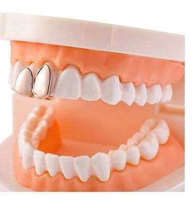2 Teeth Rose Gold Grillz – Rhino Grillz