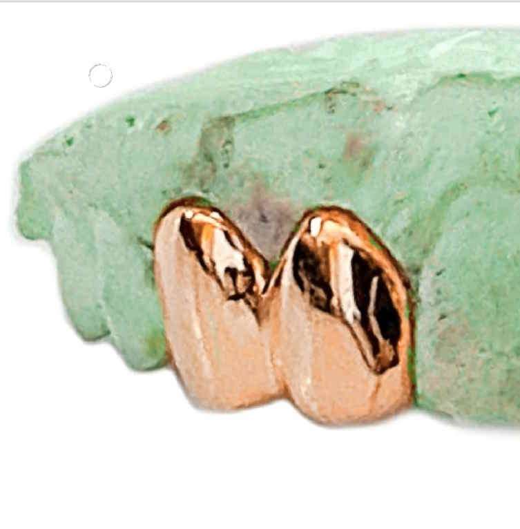 [Custom] Rose Gold Double Teeth Grillz Cap – Rhino Grillz