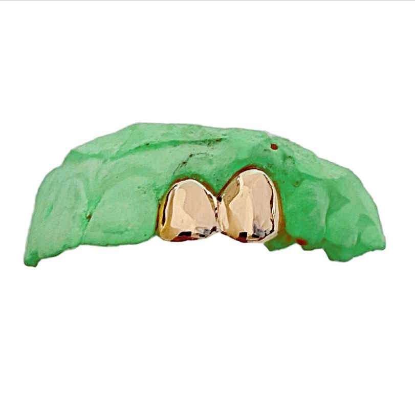 [Custom] Rose Gold Double Teeth Grillz Cap – Rhino Grillz